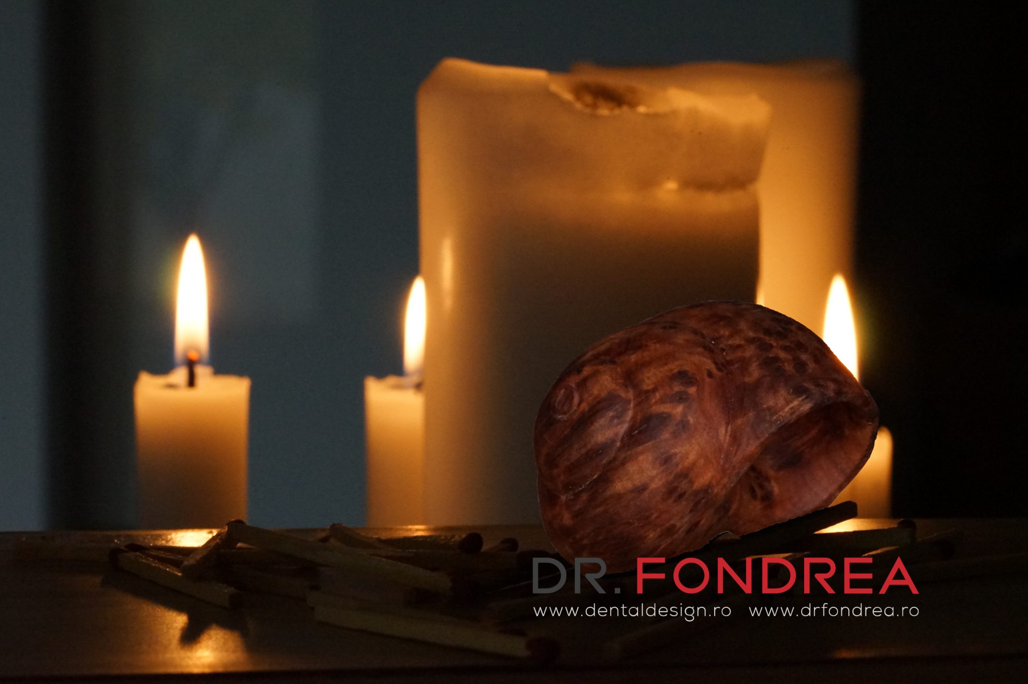 Parodontita - inflamația care scurtează viața - Dr. Bogdan Fondrea